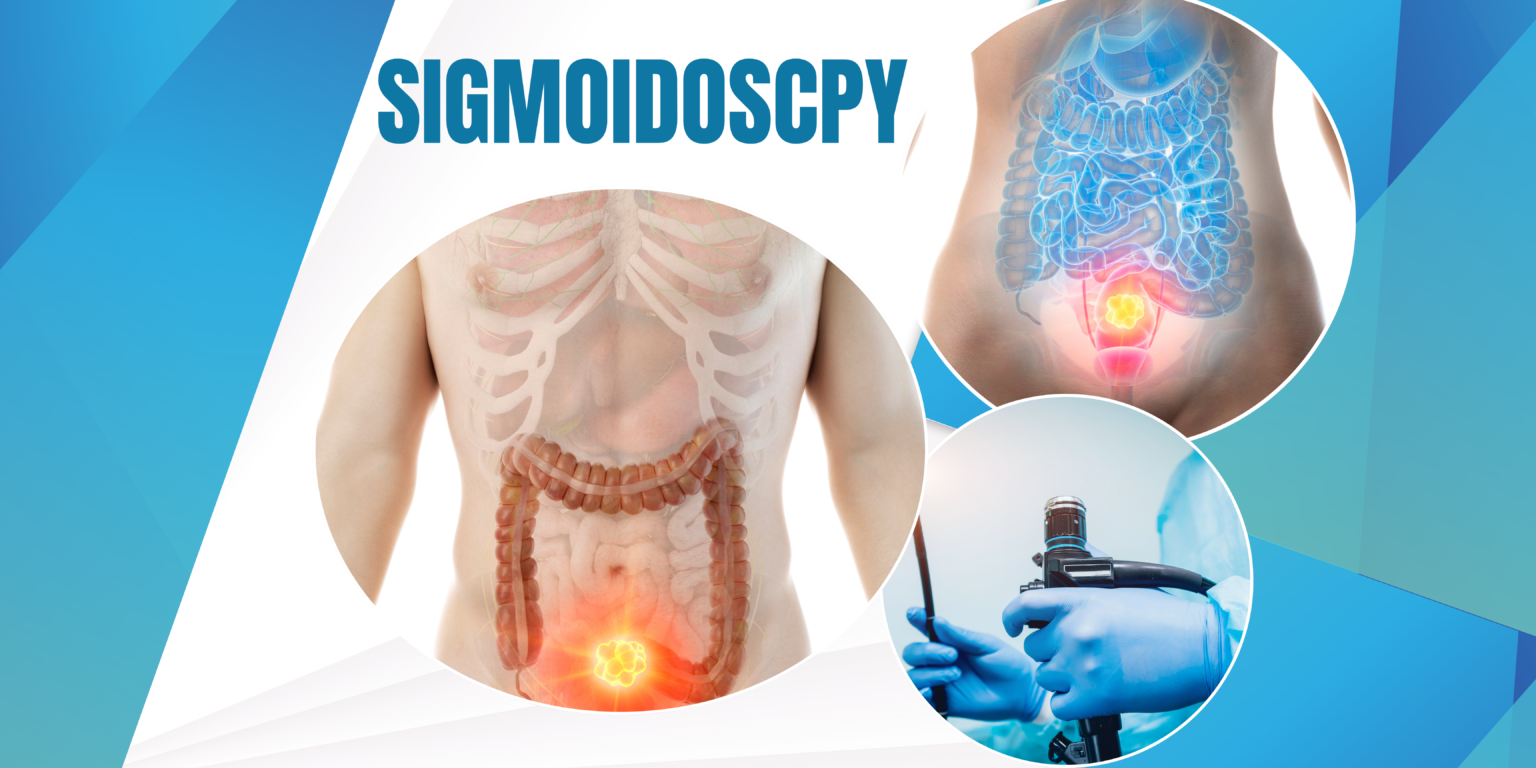 Sigmoidoscopy – drnehaberry.com